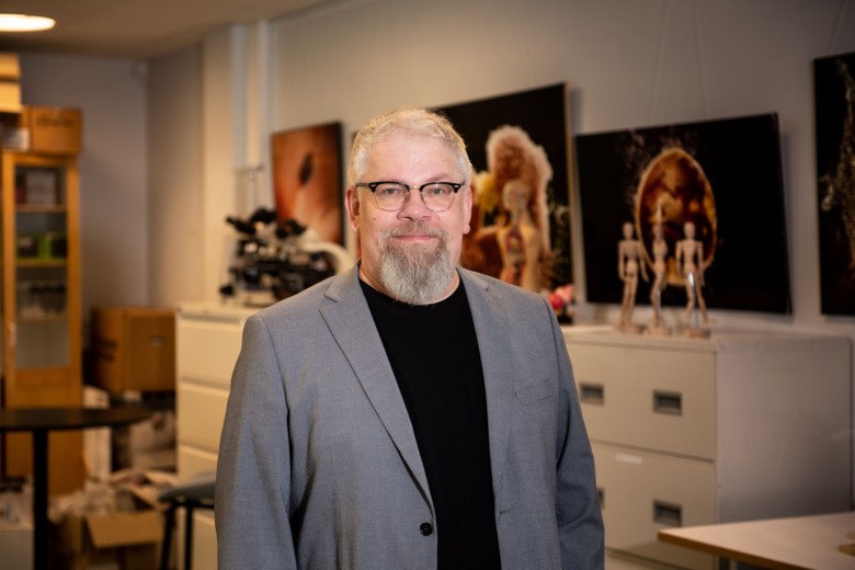 Molecular neurodevelopment and neuro-oncology – Ola Hermanson group | Karolinska Institutet